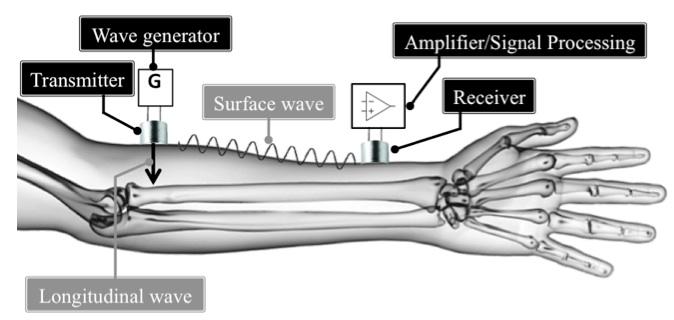 The Sound of Touch: On-body Touch and Gesture Sensing Based on ...
